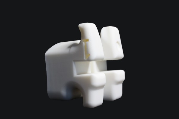 Dentist in Edmonton - Towne Square Ortho